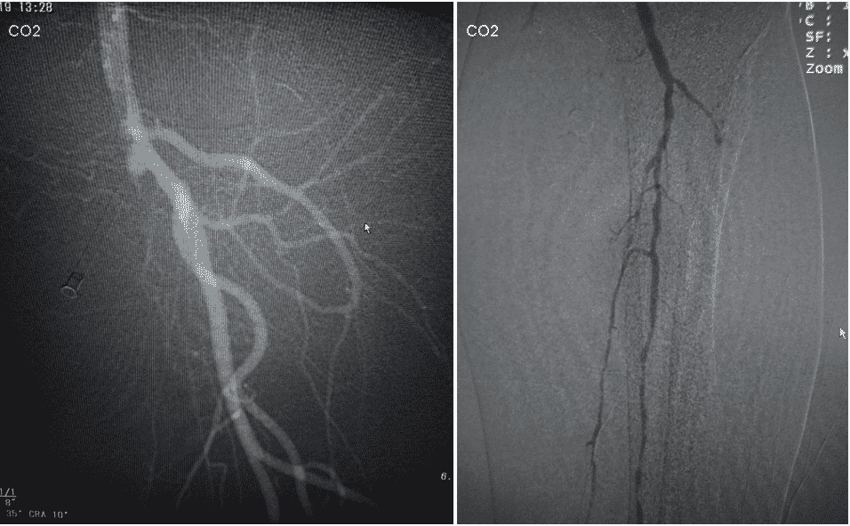 apic2019-angiodroid|apic-2019-angiodroid|apic2019-angiodroid|angiodroid ...
